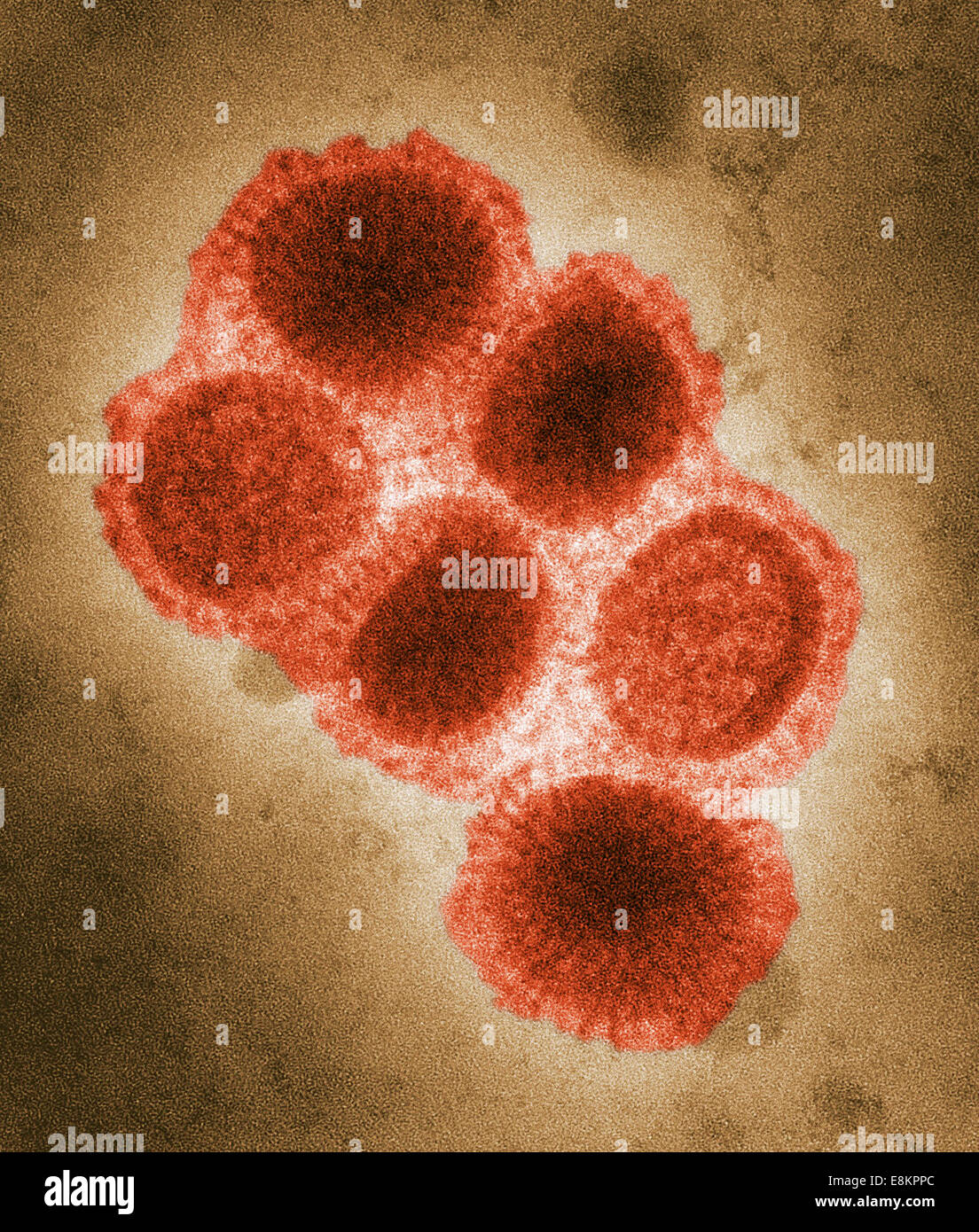 This colorized negative stained transmission electron micrograph (TEM ...