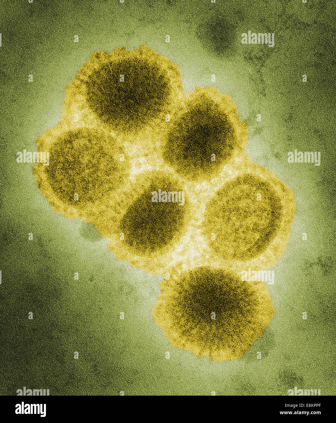 This colorized negative stained transmission electron micrograph (TEM ...