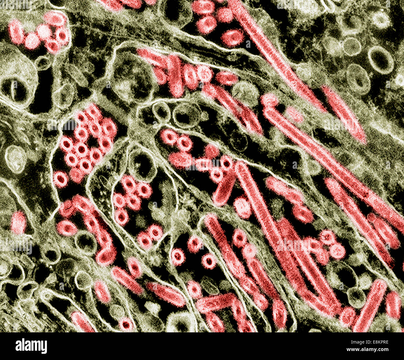 Transmission electron microscopy cells hi-res stock photography and images - Alamy