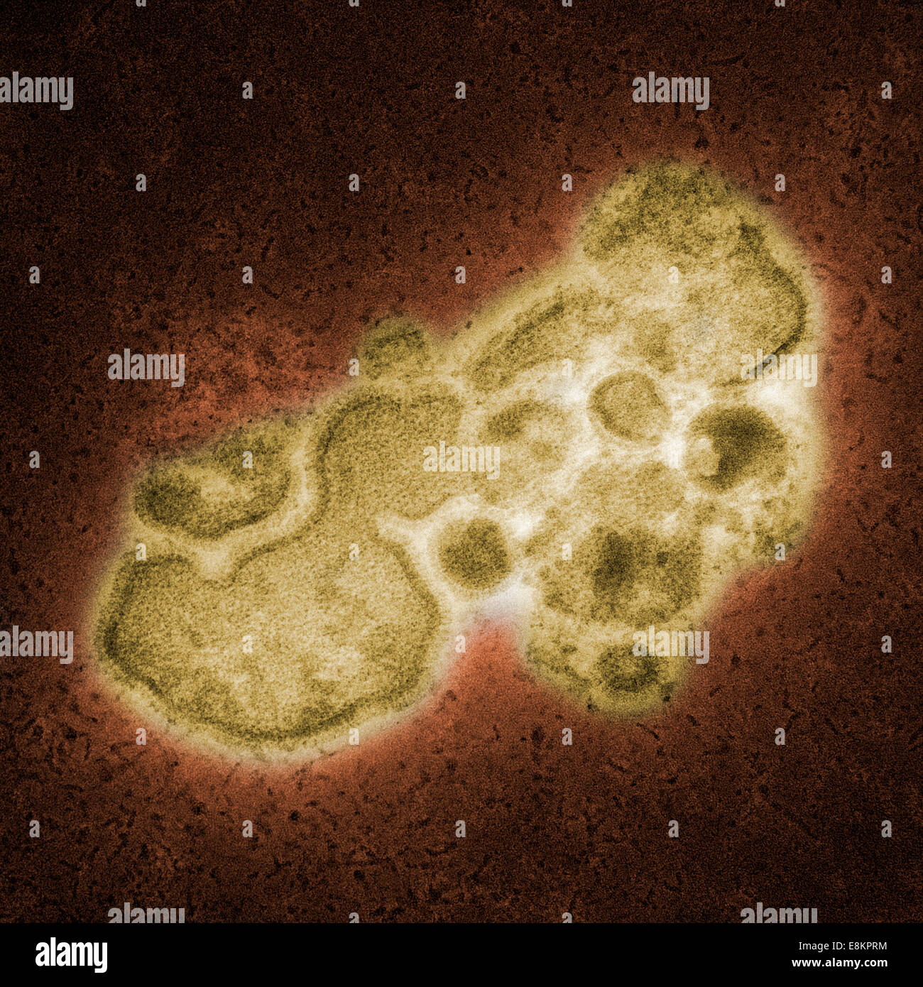 This colorized negatively-stained transmission electron micrograph (TEM ...