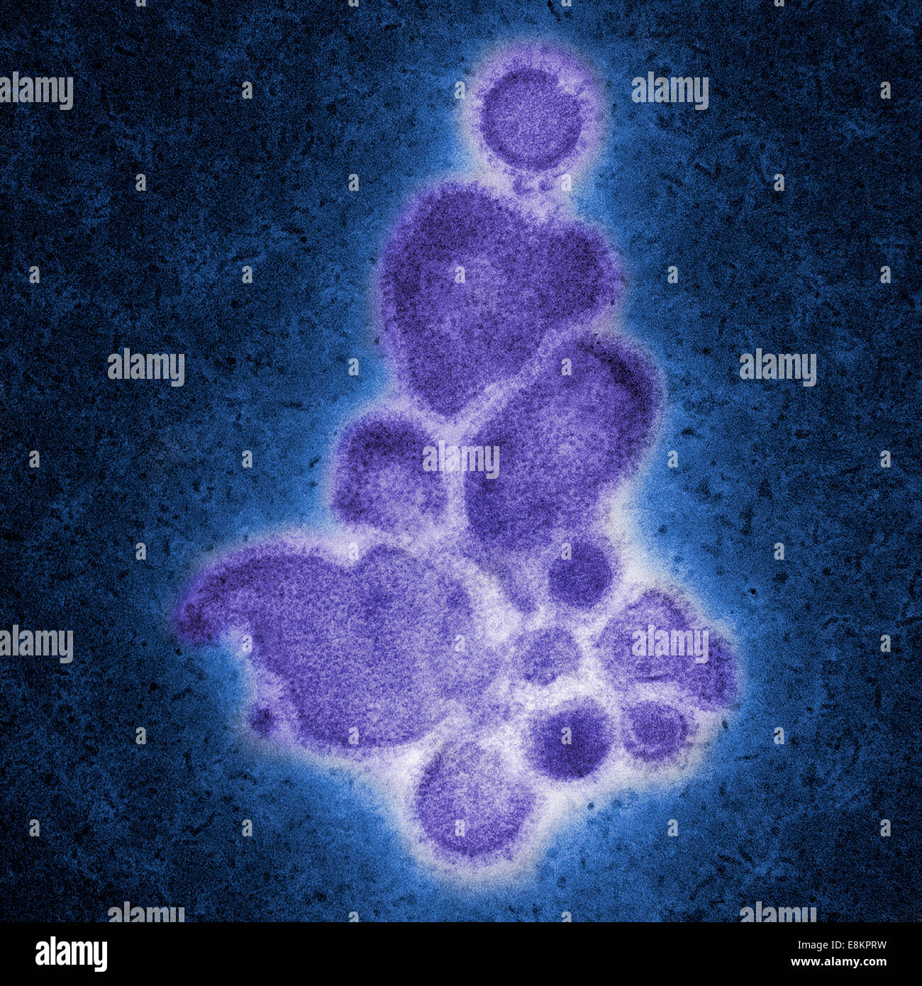 This colorized negatively-stained transmission electron micrograph (TEM ...