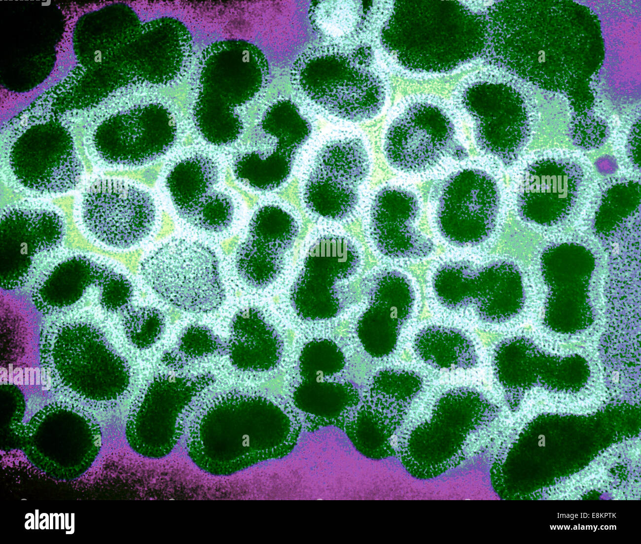 This colorized transmission electron micrograph (TEM) depicts numbers ...