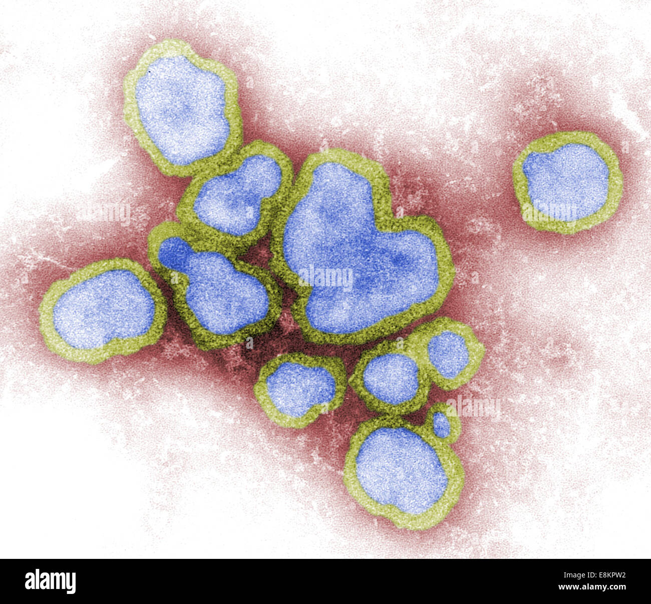 This digitally-colorized negative-stained transmission electron ... This digitally-colorized negative-stained transmission electron ...