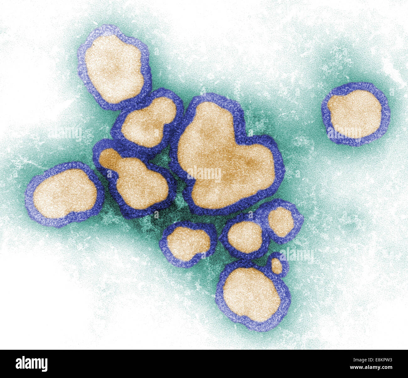 This digitally-colorized negative-stained transmission electron ... This digitally-colorized negative-stained transmission electron ...