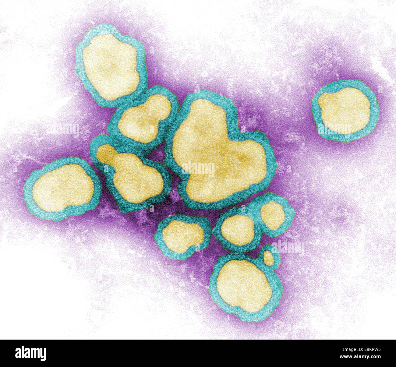 This digitally-colorized negative-stained transmission electron ... This digitally-colorized negative-stained transmission electron ...