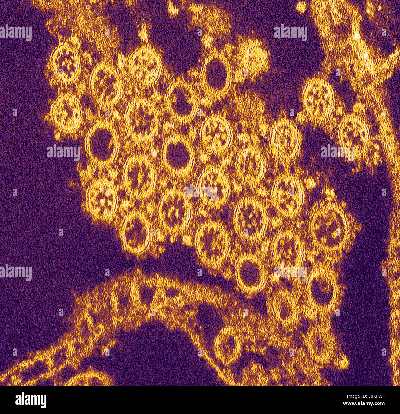This highly-magnified, digitally-colorized transmission electron ... This highly-magnified, digitally-colorized transmission electron ...