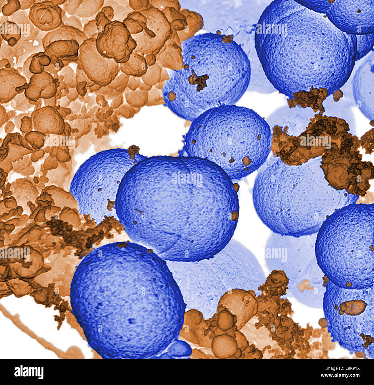 Scanning electron micrograph of S. aureus bacteria escaping destruction ...