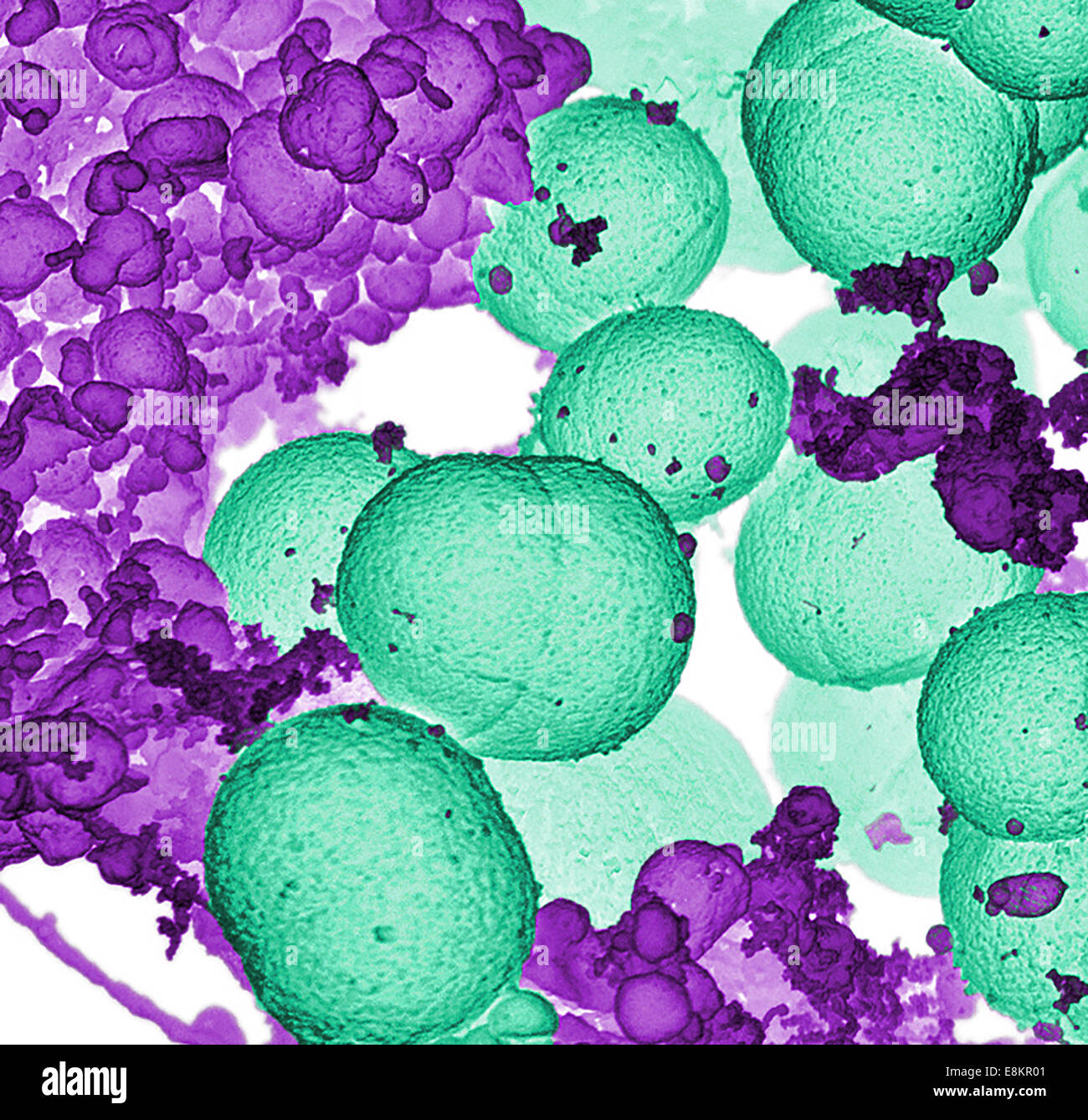 Bacteria cell electron micrograph hi-res stock photography and images ...