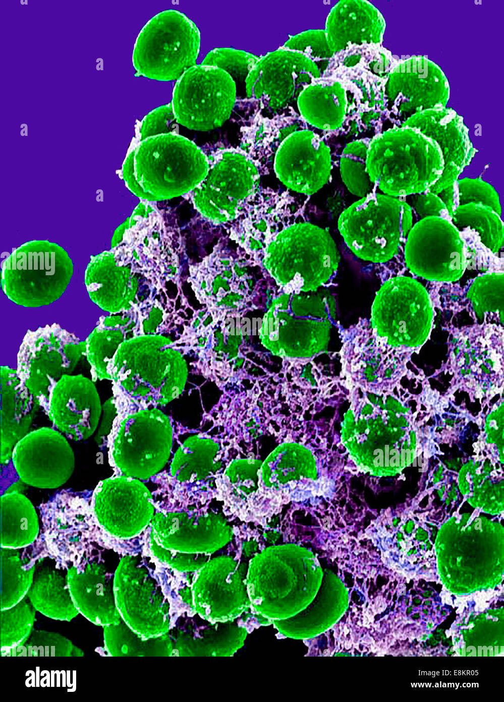 Scanning electron micrograph of clump of Staphylococcus epidermidis ...
