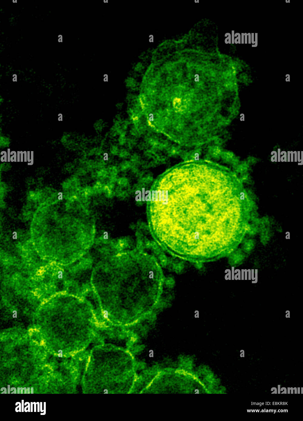 Colorized transmission electron micrograph showing particles of Middle ...