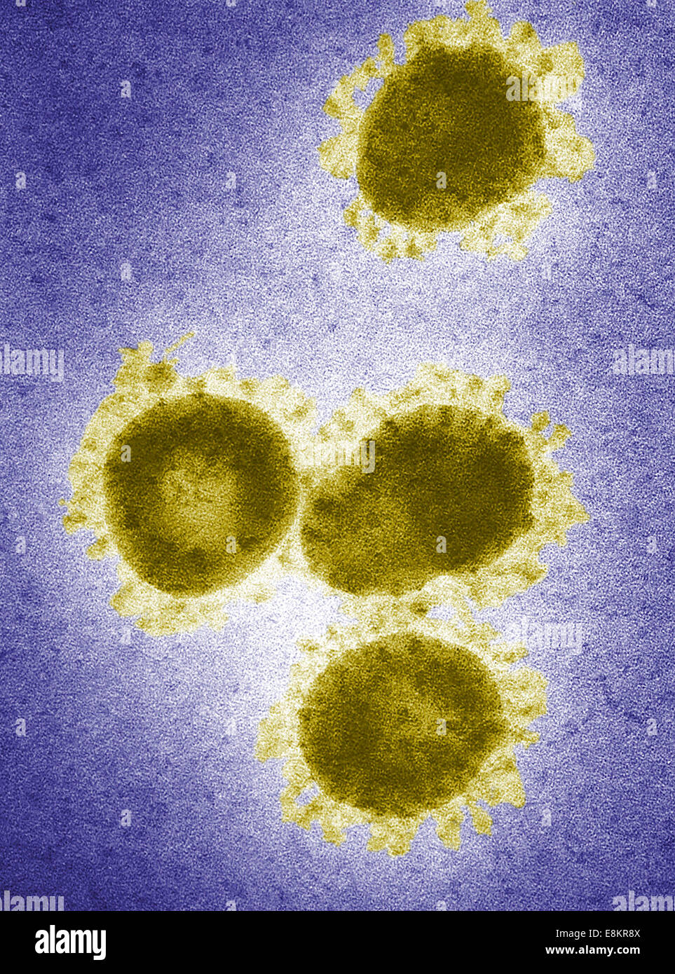 This digitally-colorized transmission electron micrograph (TEM ...