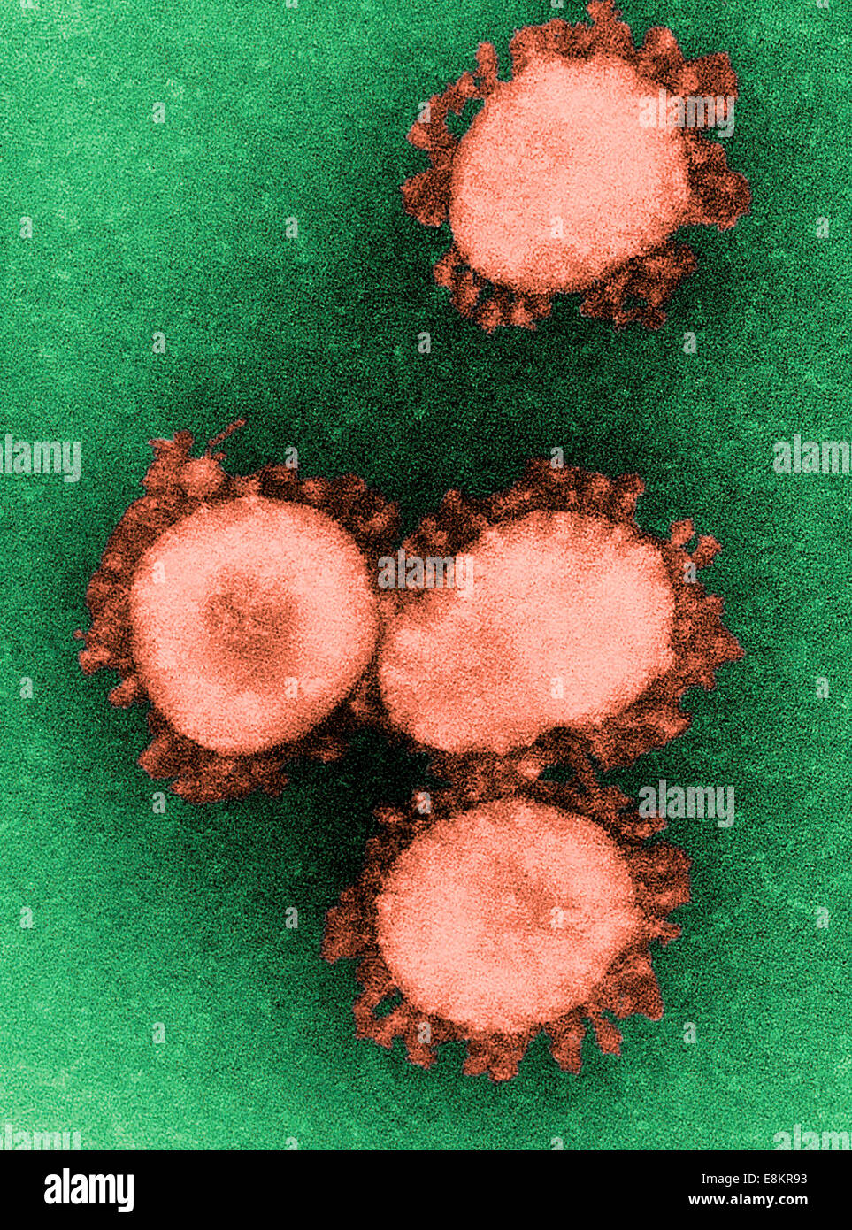 This digitally-colorized transmission electron micrograph (TEM ...