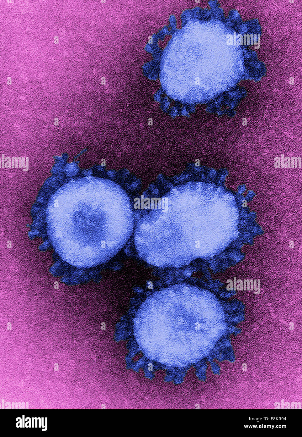 This digitally-colorized transmission electron micrograph (TEM ...