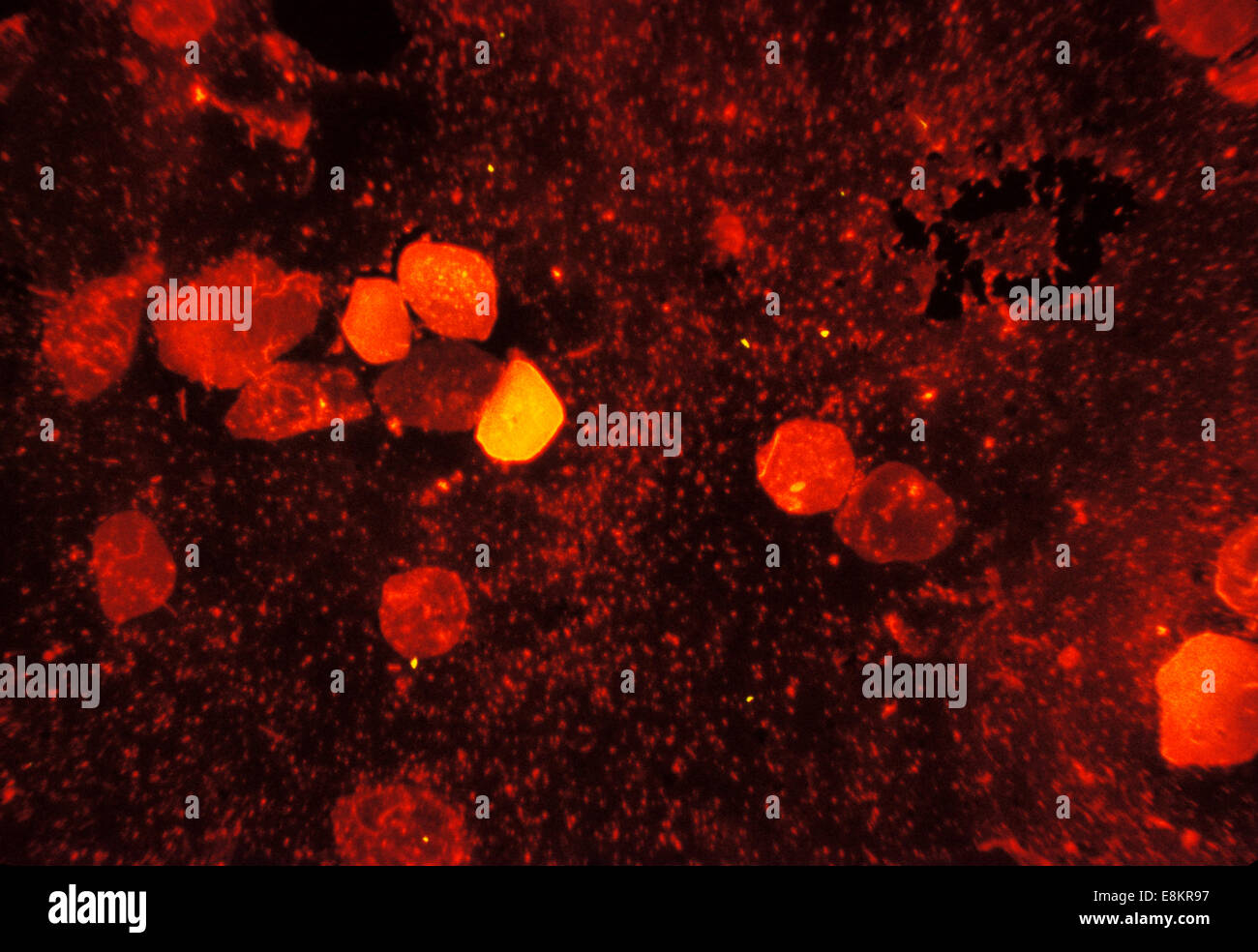 Mycobacterium tuberculosis fluorescence hi-res stock photography and images - Alamy