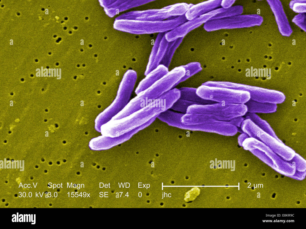 Bacteria under microscope hi-res stock photography and images - Alamy