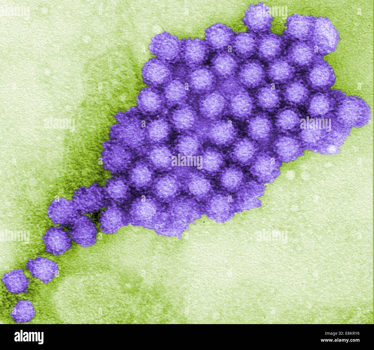 This transmission electron micrograph (TEM) revealed some of ...
