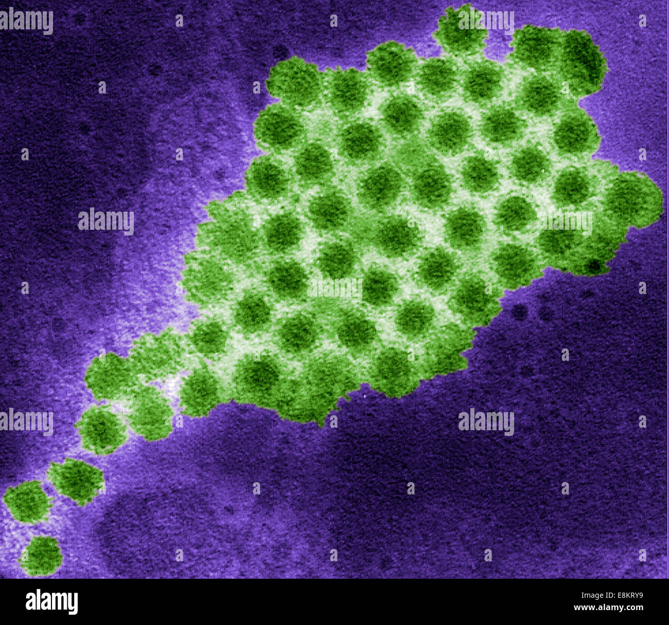Norovirus infection hi-res stock photography and images - Alamy