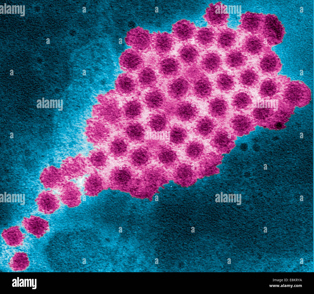 This transmission electron micrograph (TEM) revealed some of ...