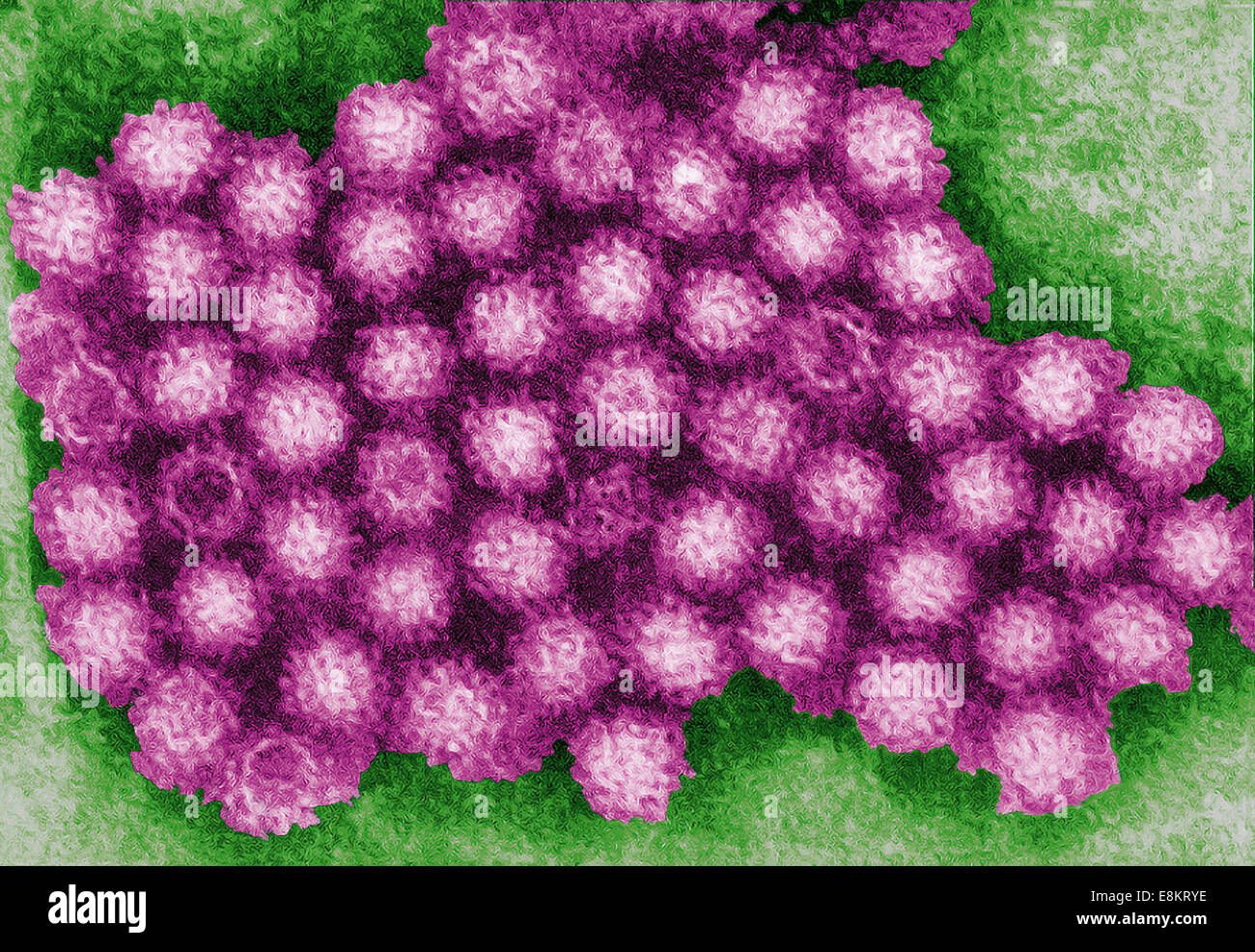 This transmission electron micrograph (TEM) revealed some of ...