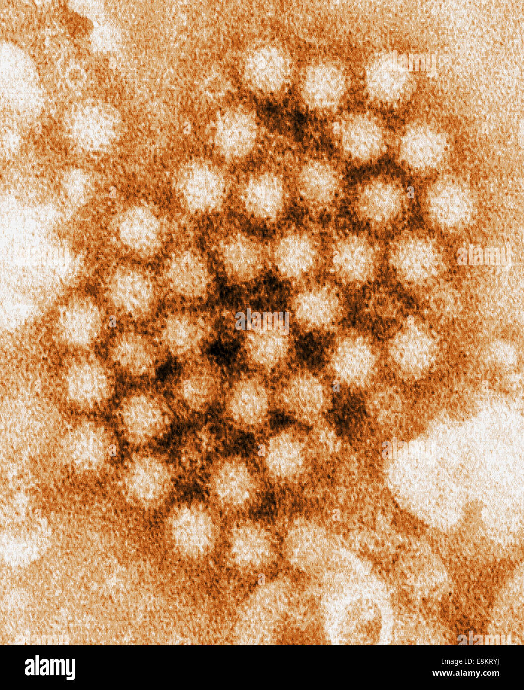 This colorized transmission electron micrograph (TEM) revealed some of ...