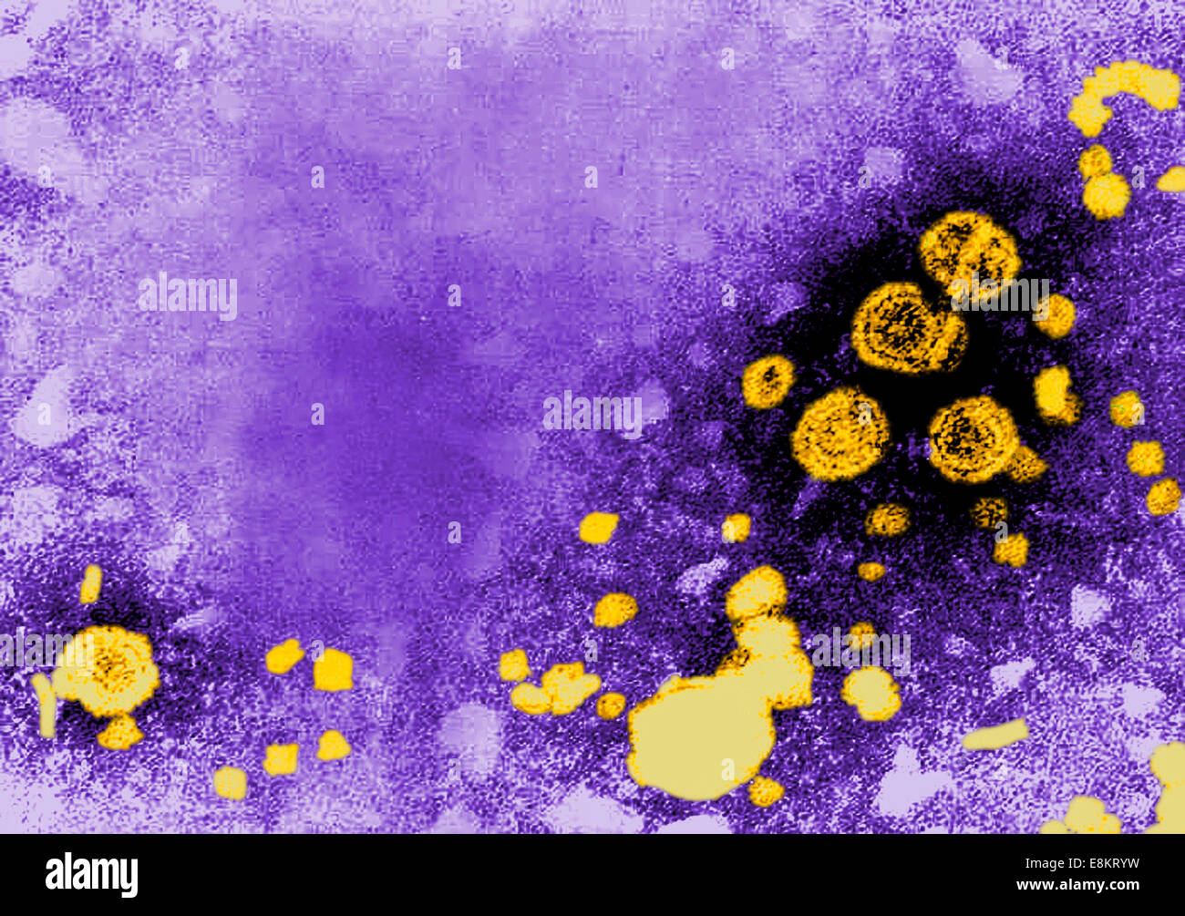 This digitally-colorized transmission electron micrograph (TEM ...