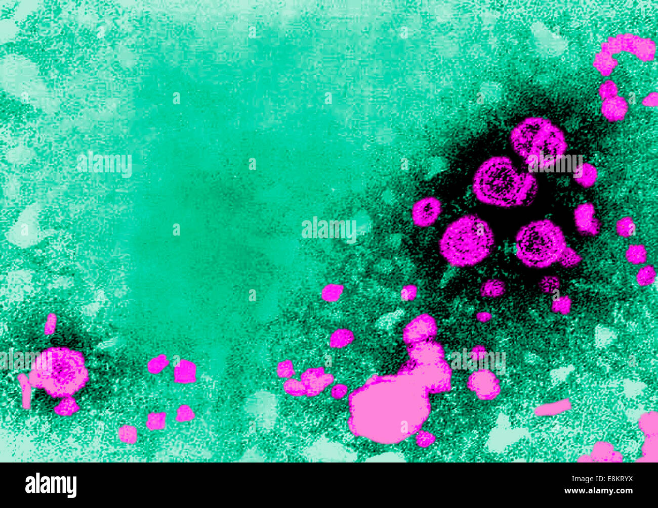 This digitally-colorized transmission electron micrograph (TEM ...