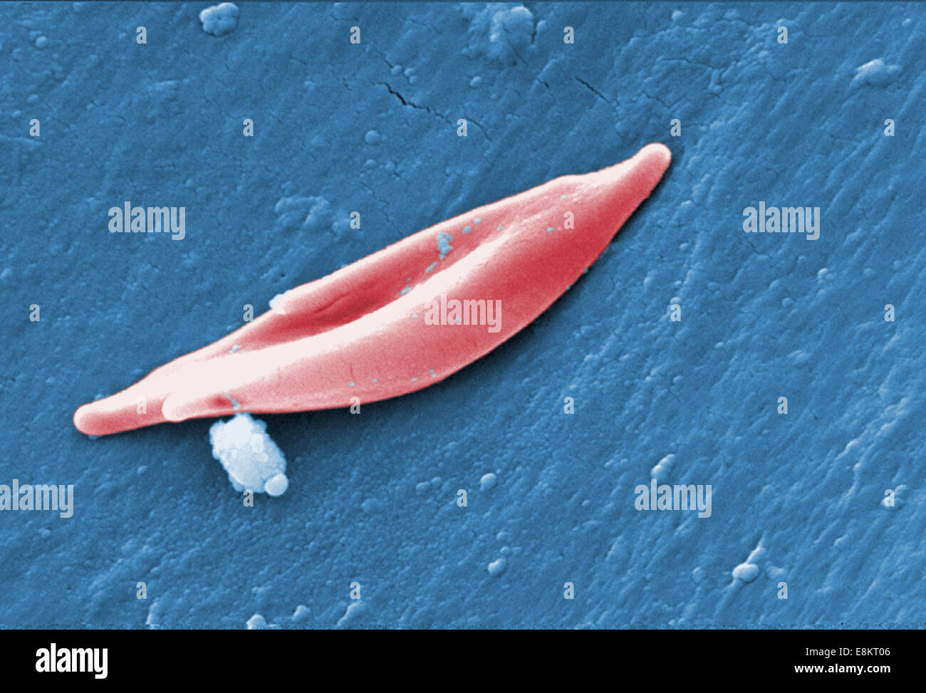 This digitally-colorized scanning electron micrograph (SEM) revealed ...