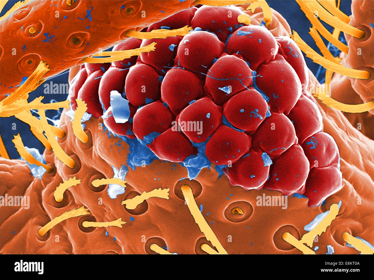 This digitally-colorized scanning electron micrograph (SEM) revealed ...