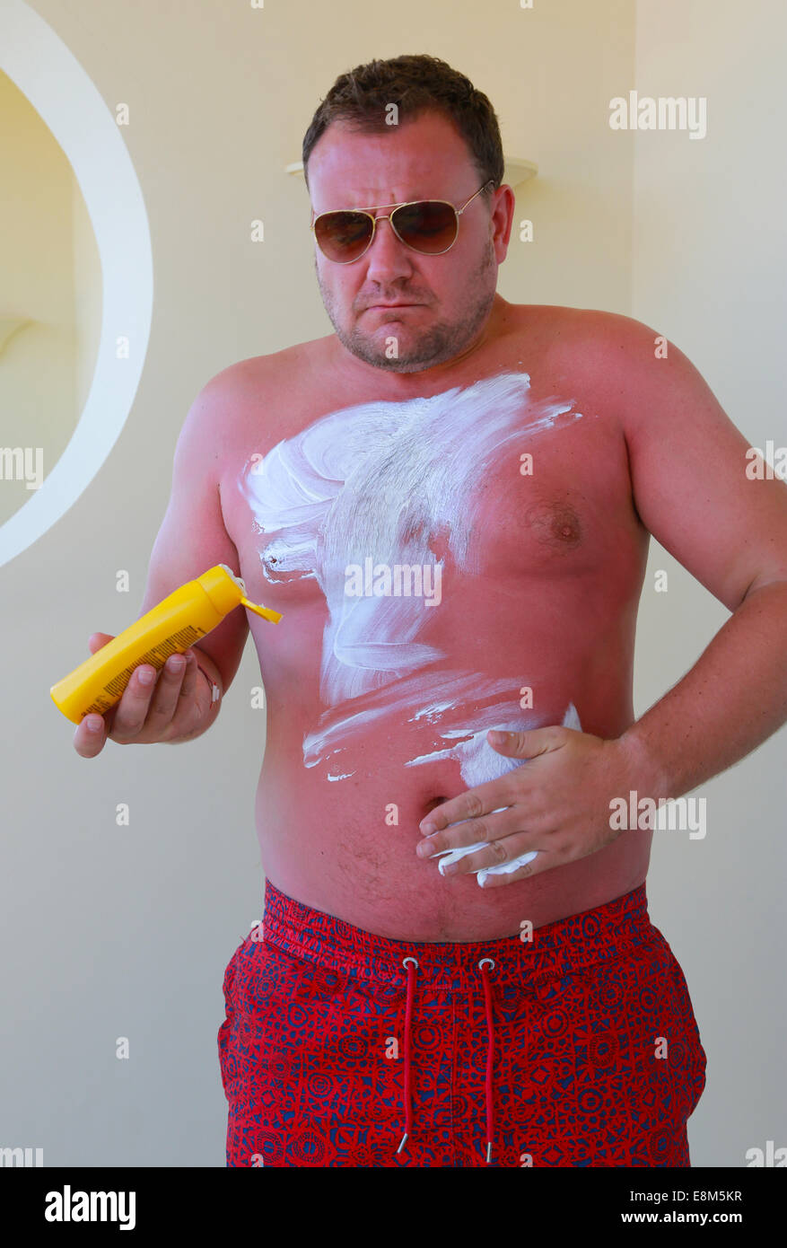 Mad badly sunburnt hi-res stock photography and images - Alamy