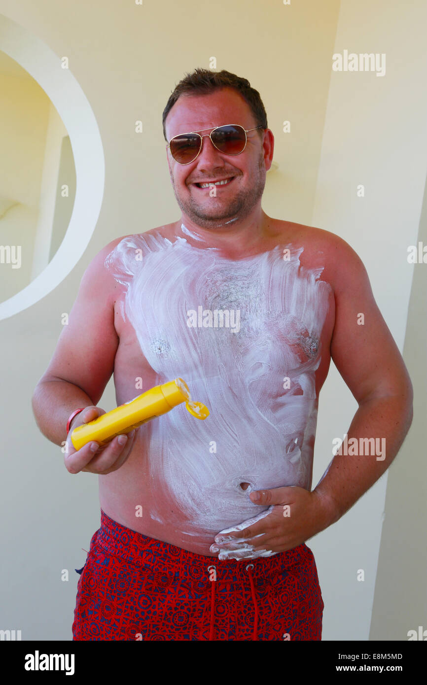 Very sun burnt man applying cream Stock Photo - Alamy