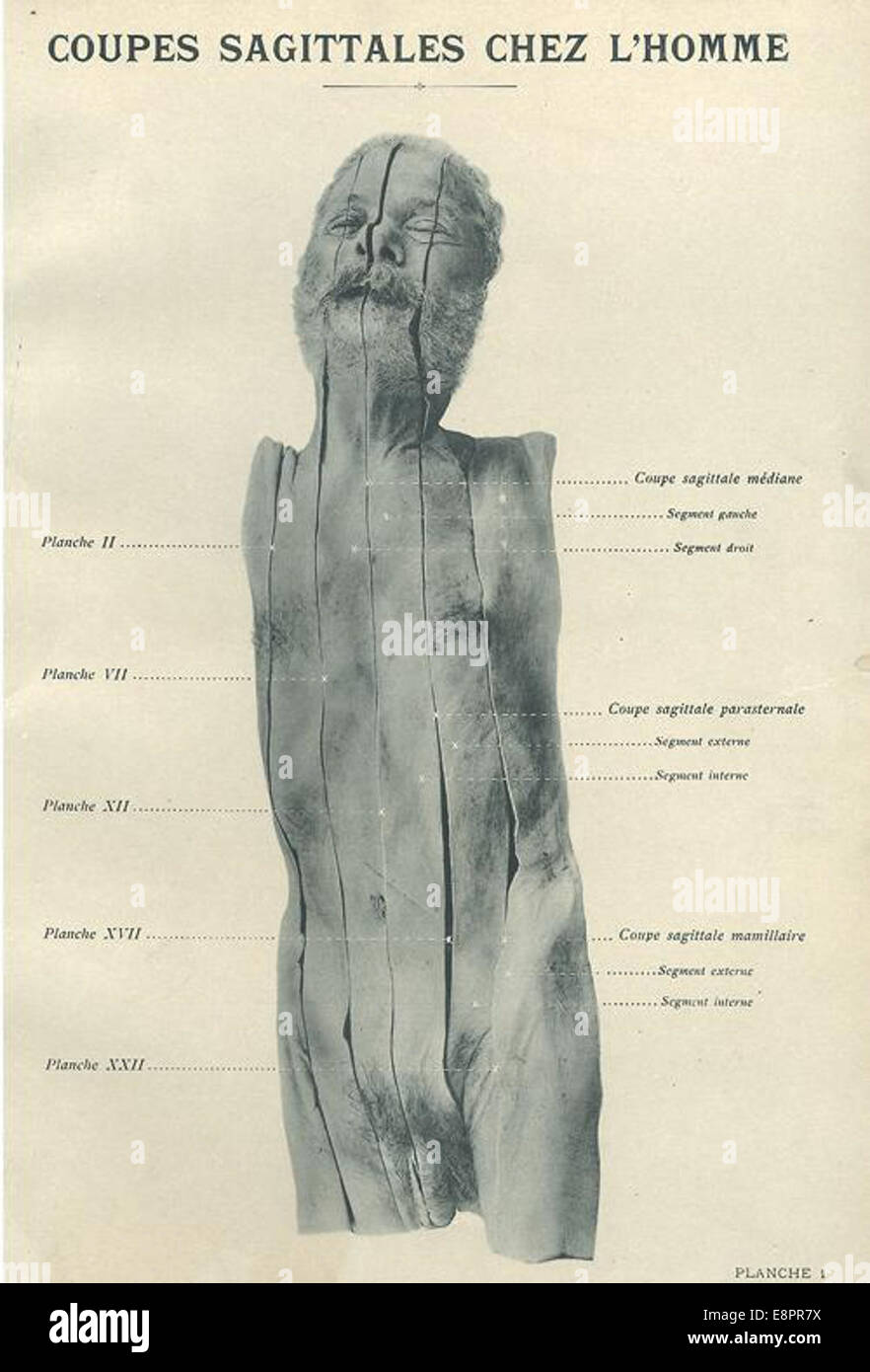 This image is a medical illustration showing sagittal sections of the ...