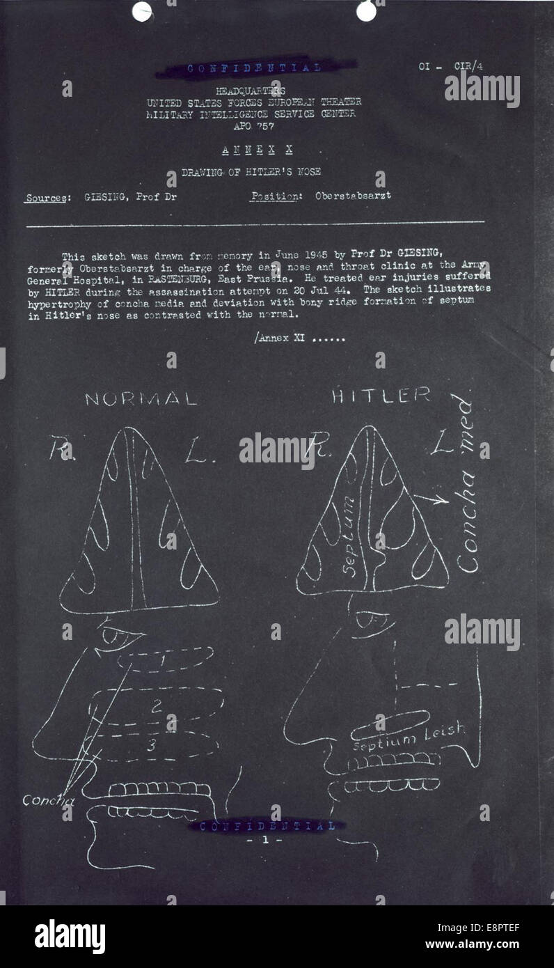 A medical illustration showing the nasal passages and teeth of Adolf ...