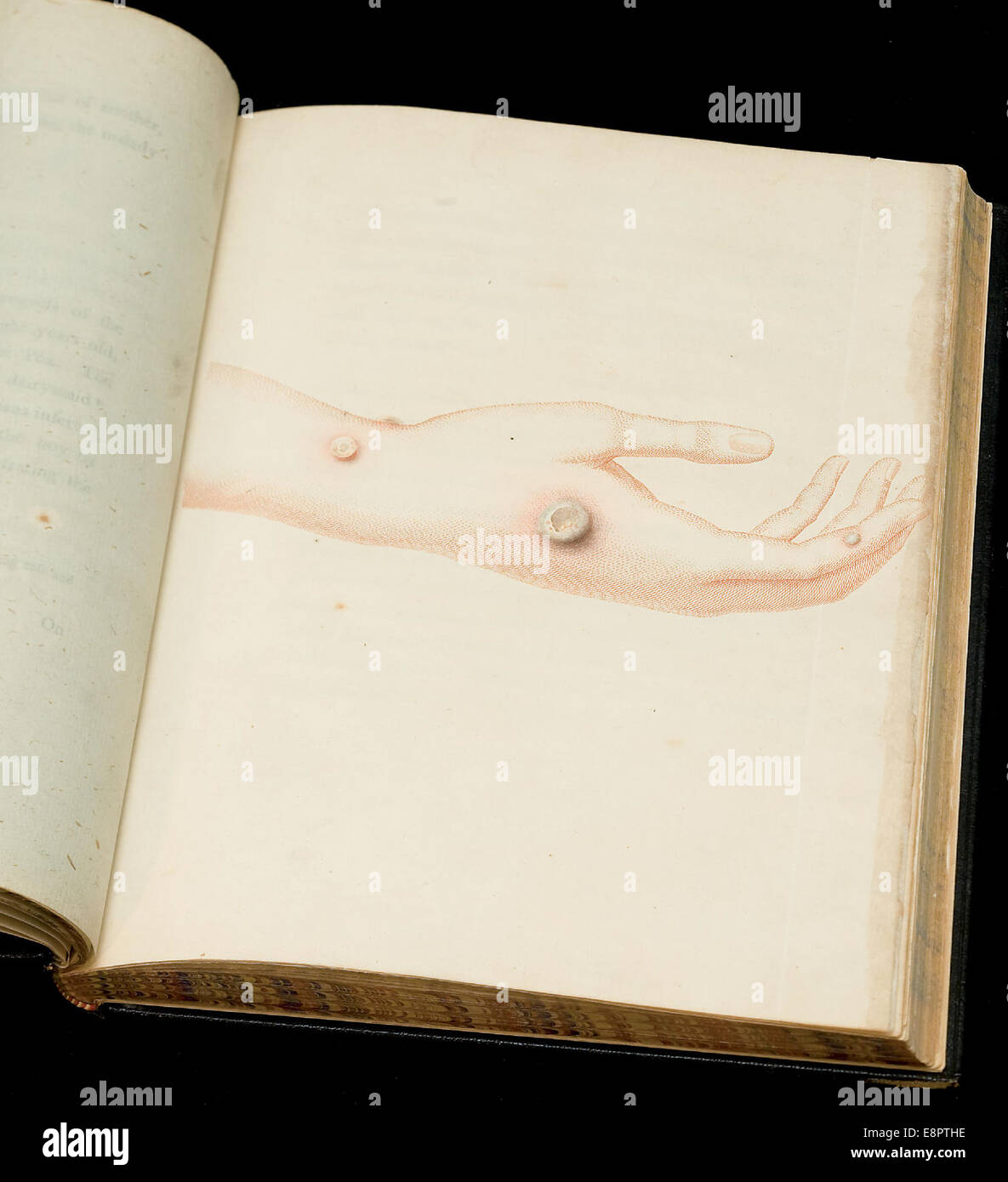 Edward jenner vaccine hi-res stock photography and images - Alamy