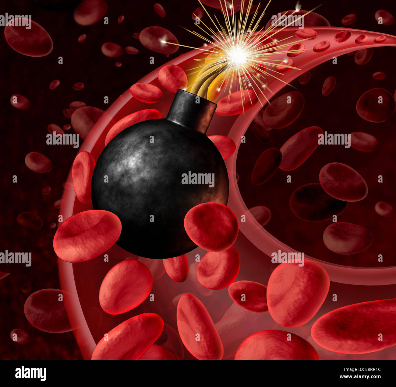 Blood circulation danger with an active inited bomb in an artery with ...
