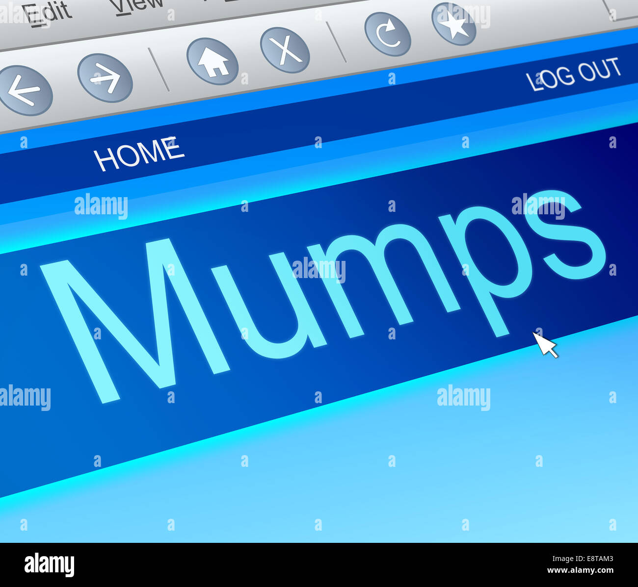 Mumps hi-res stock photography and images - Alamy