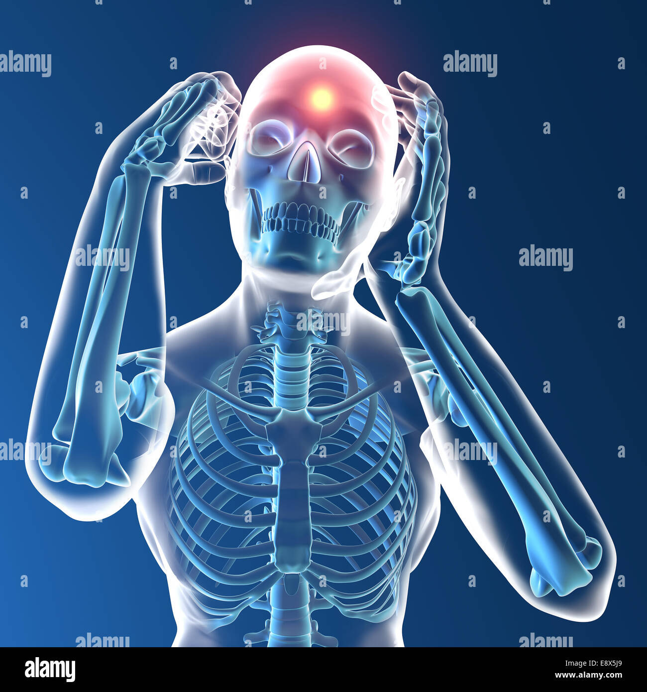 3D X-ray human with headache on dark blue background Stock Photo - Alamy
