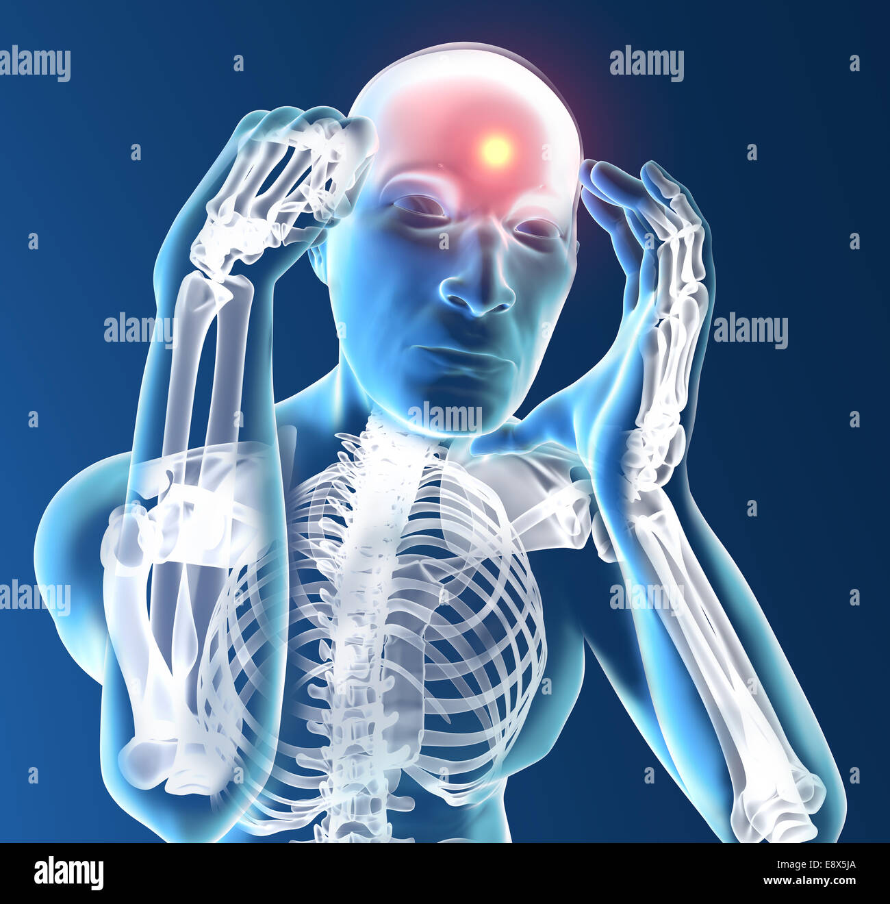 3D X-ray human with headache on dark blue background Stock Photo - Alamy
