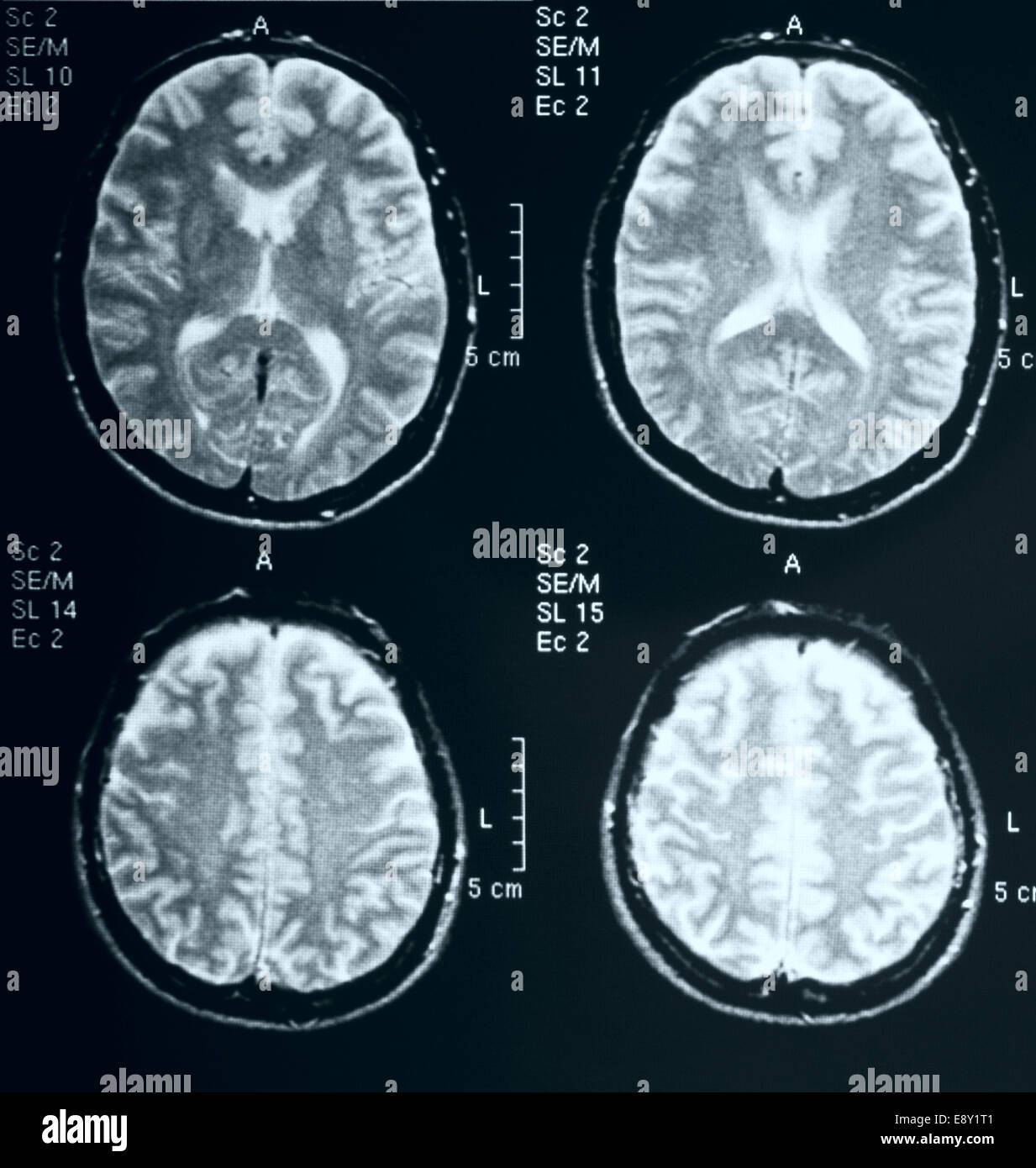 Mrt image hi-res stock photography and images - Alamy