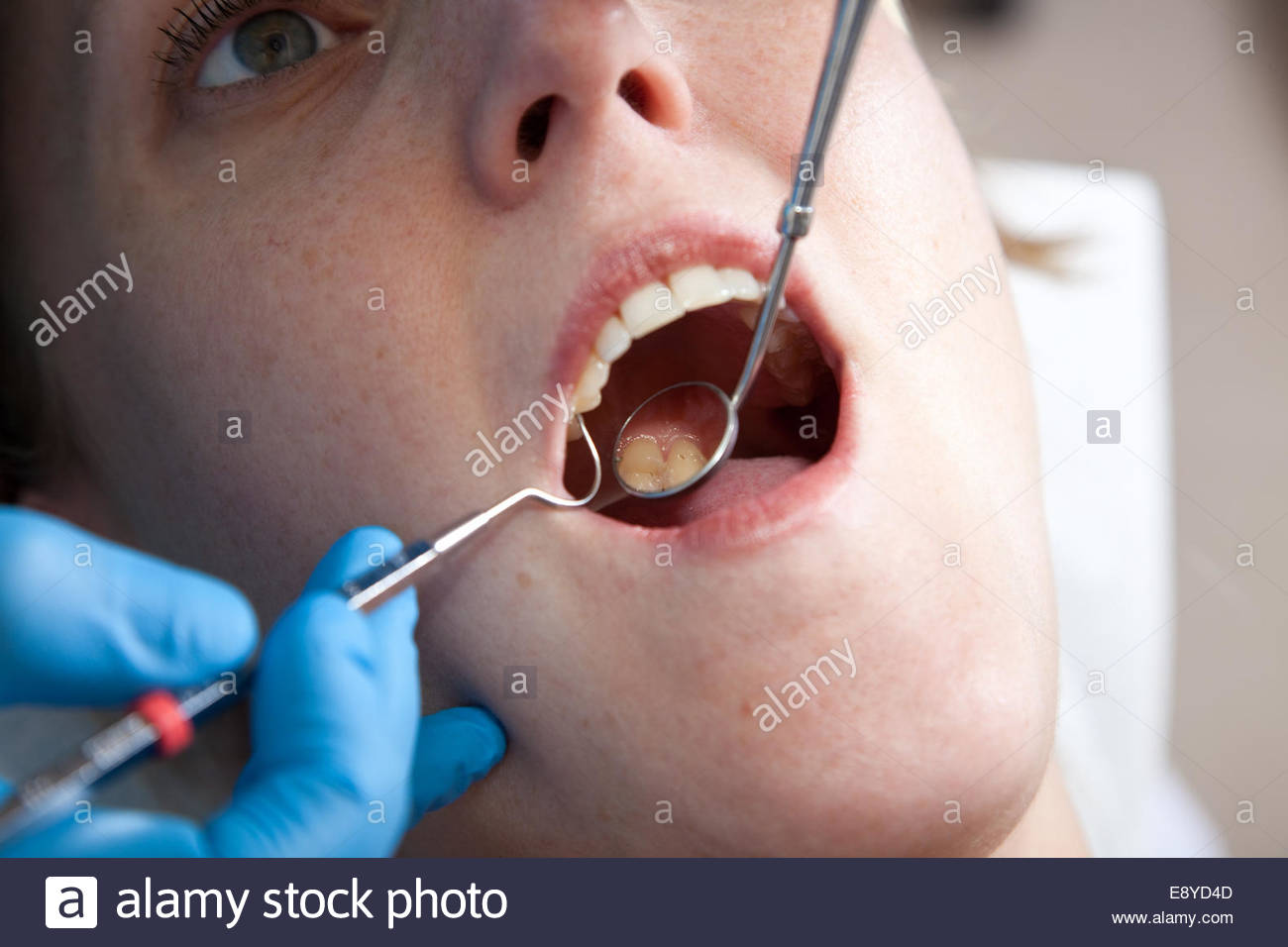 Cavities Stock Photos & Cavities Stock Images - Alamy