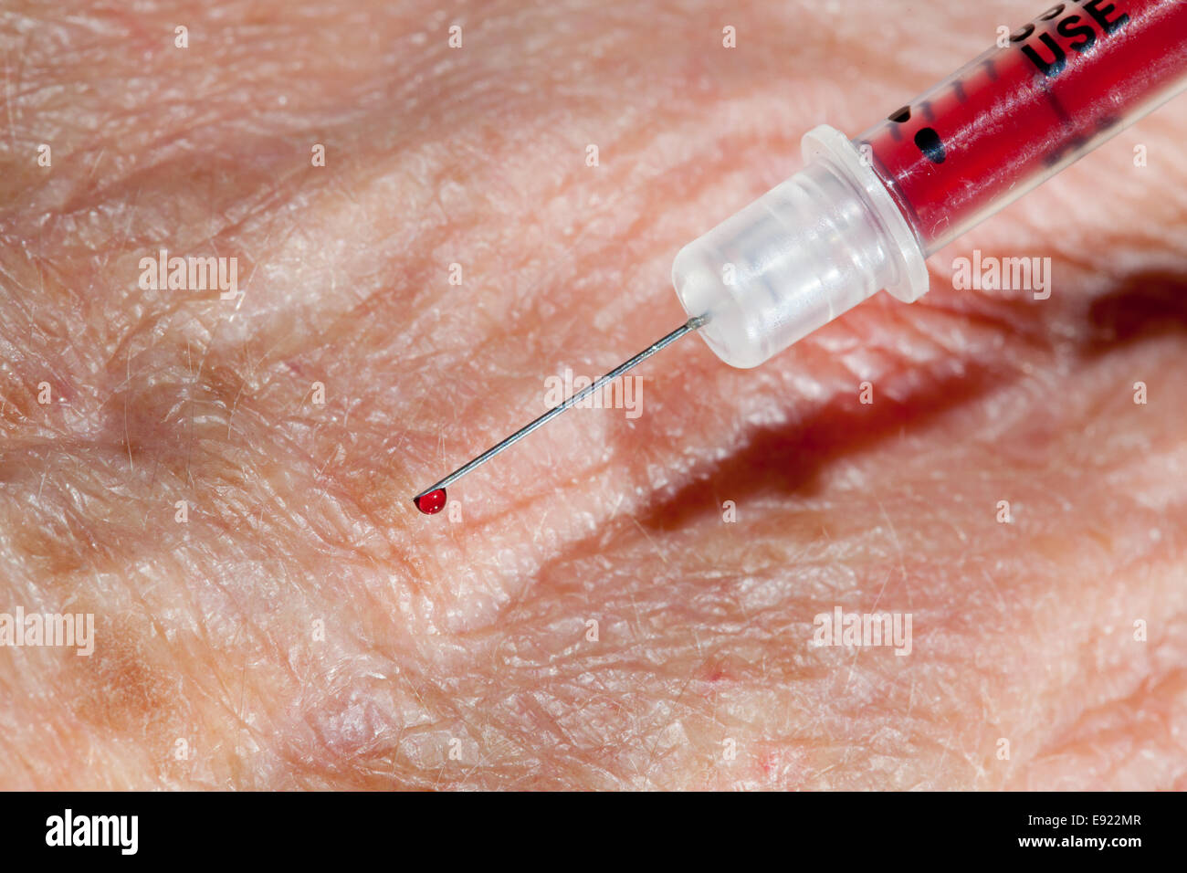 Injection into hand of senior male Stock Photo - Alamy