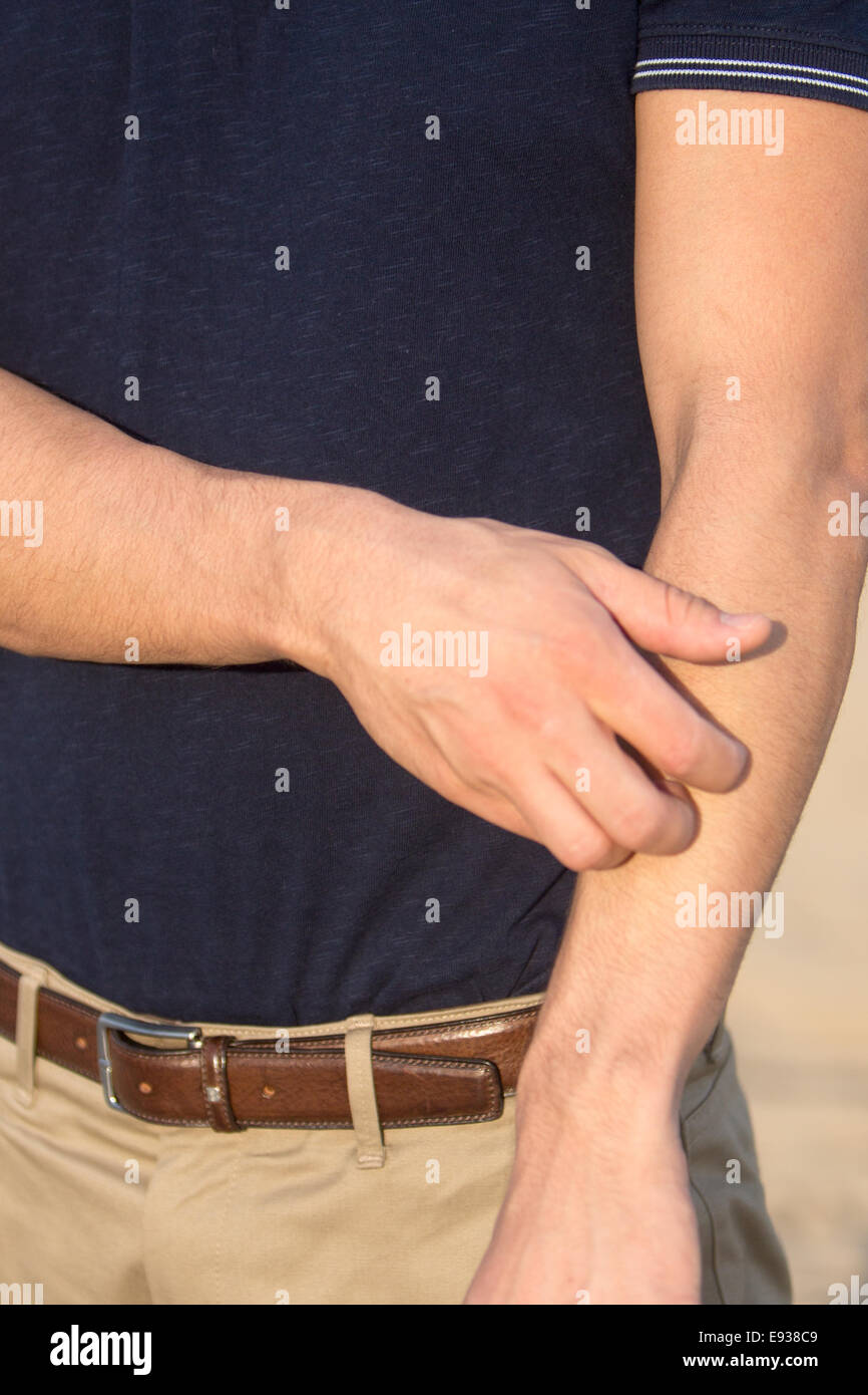 Man scratching his arm Stock Photo - Alamy