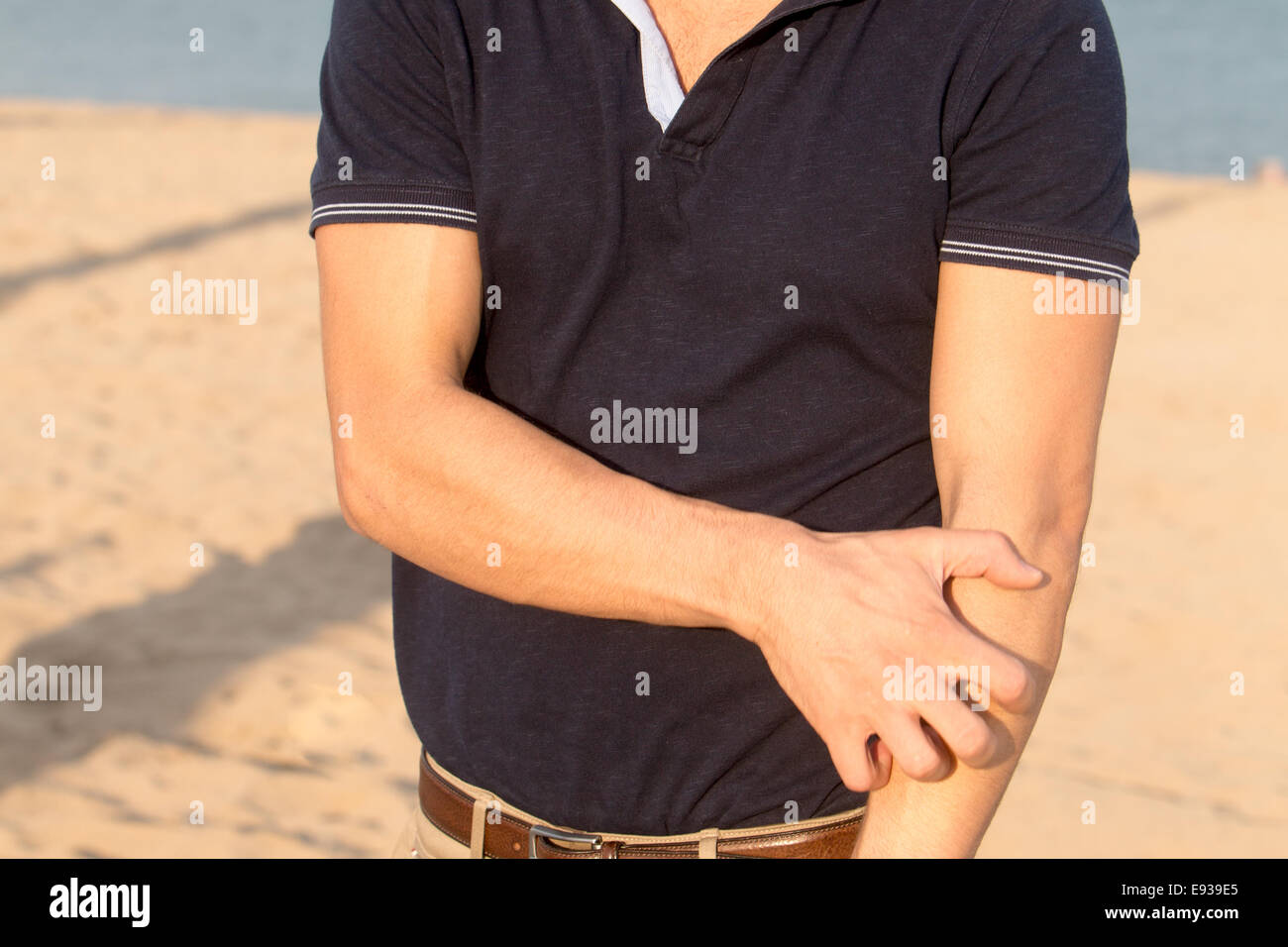 Man scratching his arm Stock Photo - Alamy