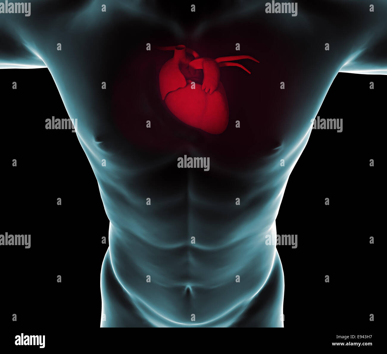 Chest x ray pacemaker hi-res stock photography and images - Alamy