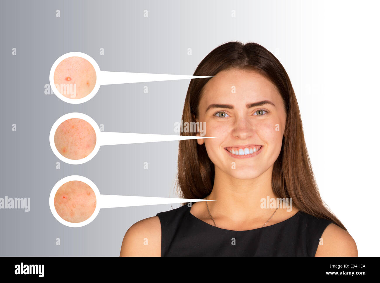 Skin damage hi-res stock photography and images - Alamy