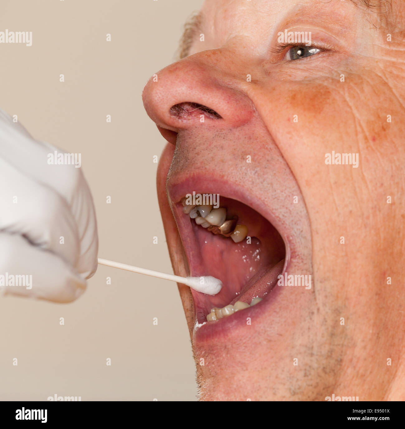 Human saliva hi-res stock photography and images - Alamy