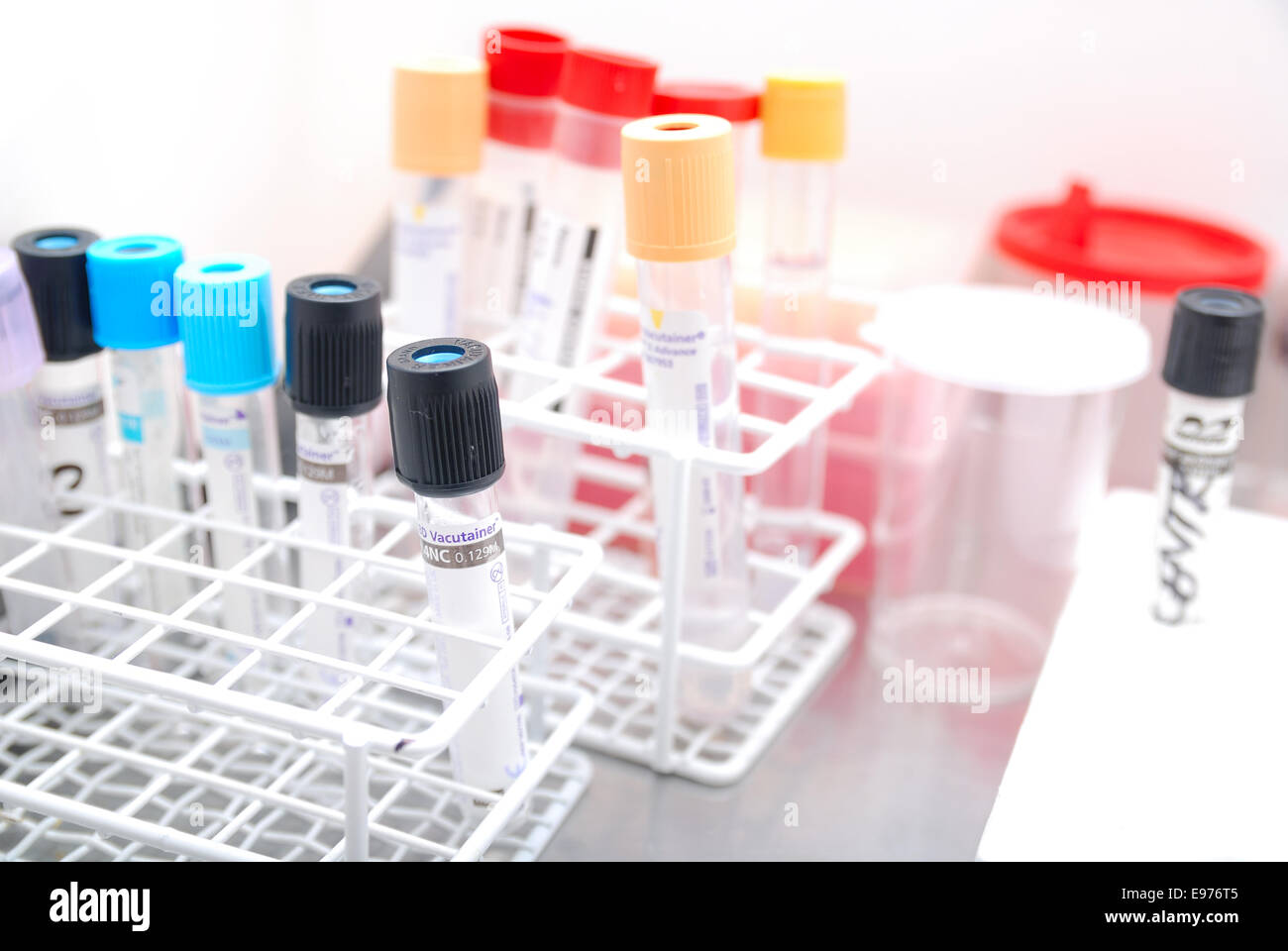 Boiling analysis hi-res stock photography and images - Alamy