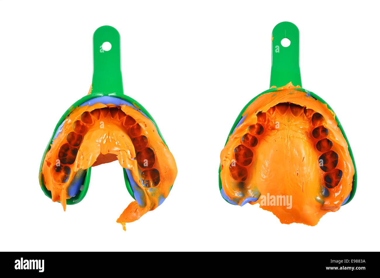 dental impression with silicone material from teeth Stock Photo - Alamy