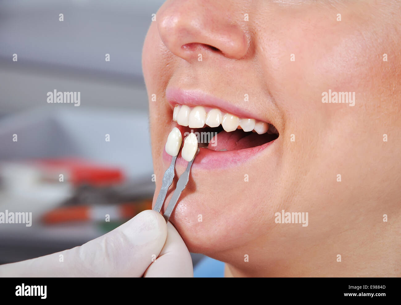 shade determination tooth with help of a shade guide, close up Stock ...