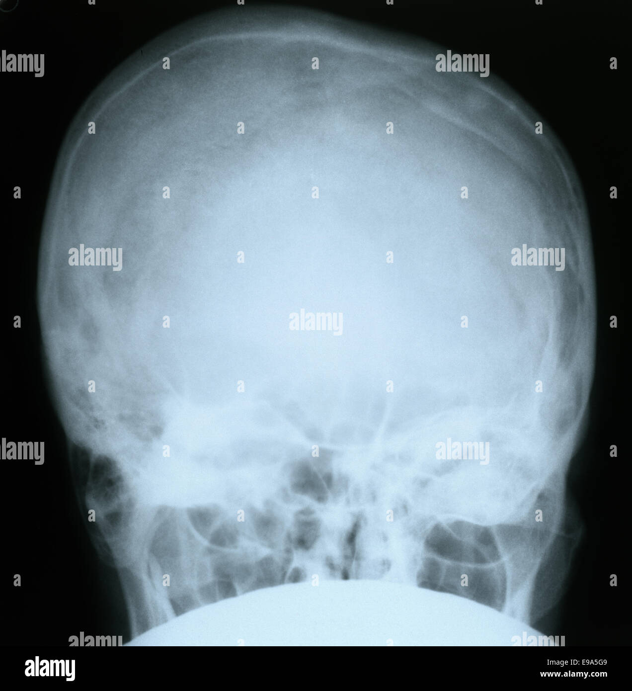 Anatomy rear view back human hi-res stock photography and images - Alamy
