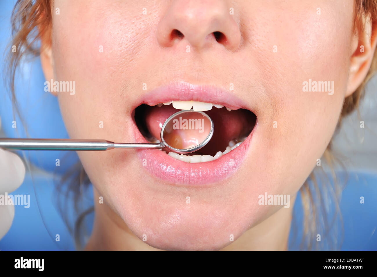 dentist examines oral teeth mirror Stock Photo - Alamy
